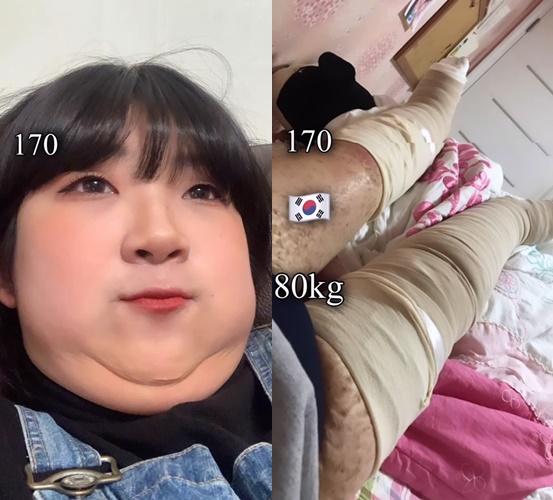 최준희, '80kg→49kg' 다이어트 근황…"사람 하나 빠져나간 몸" - 나무뉴스