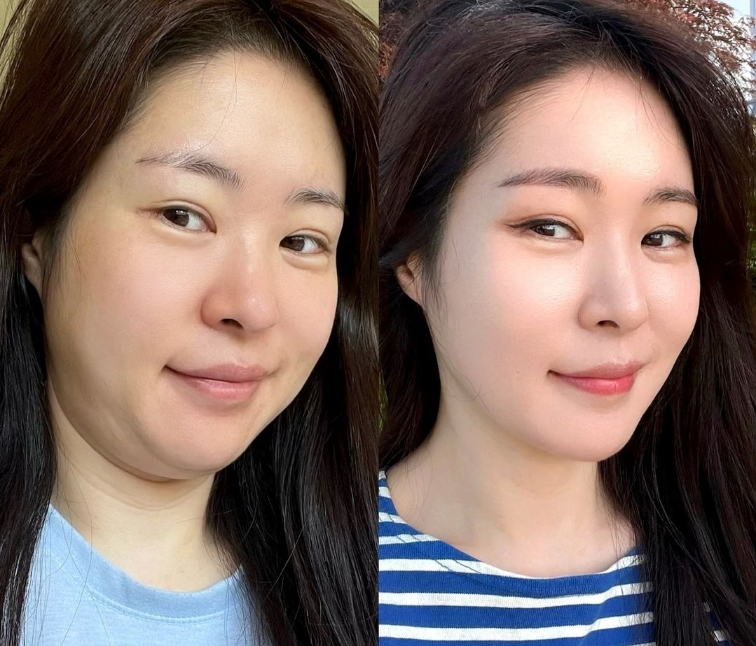 '80→48kg' 미자, 다이어트 비결='급진급빠'…"체중 집착 NO" - 나무뉴스