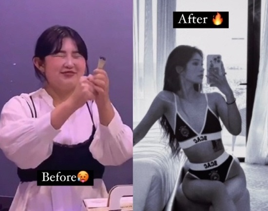 '루푸스 병→44kg 감량' 최준희, 골반 괴사까지…우여곡절 건강사 [엑's 이슈] - 나무뉴스