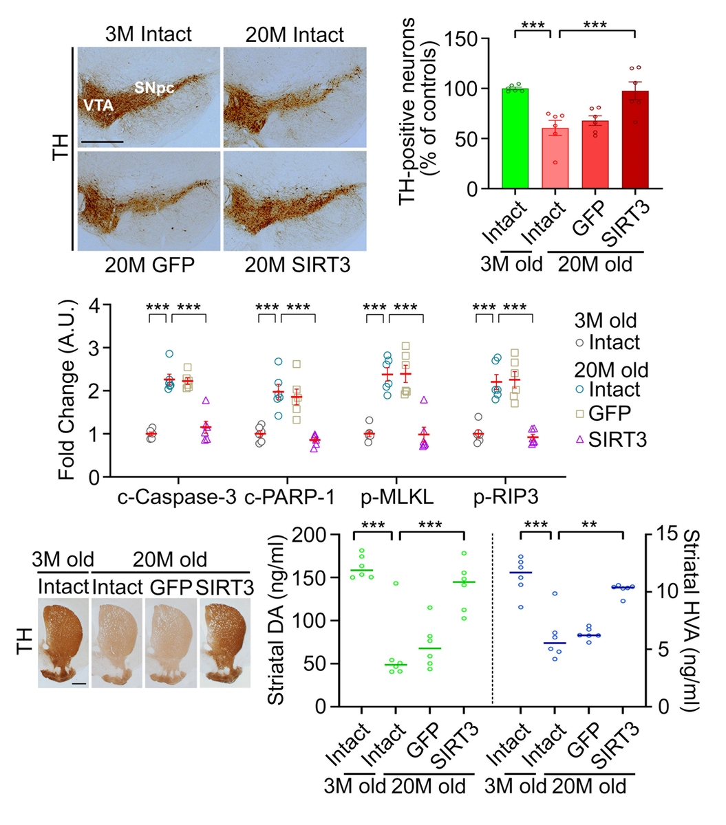 나이 들수록 근육 줄어드는 이유 뇌에서 찾았다 (연합뉴스) - 나무뉴스