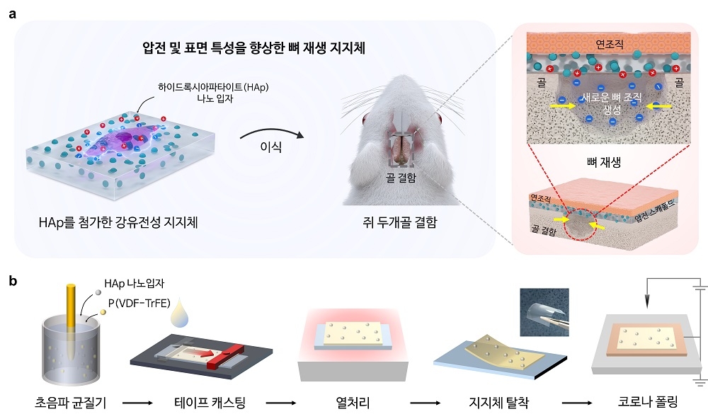 금 간 뼈에 '뼈 반창고'…KAIST, 신소재 개발 (연합뉴스) - 나무뉴스