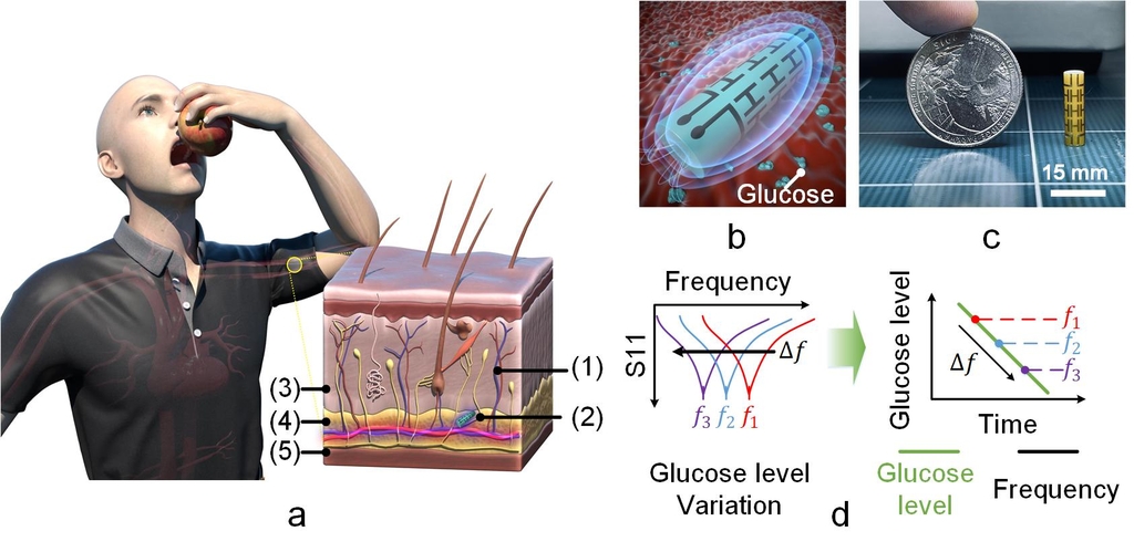 UNIST, 피 뽑지 않고 혈당 측정하는 기술 개발 (연합뉴스) - 나무뉴스